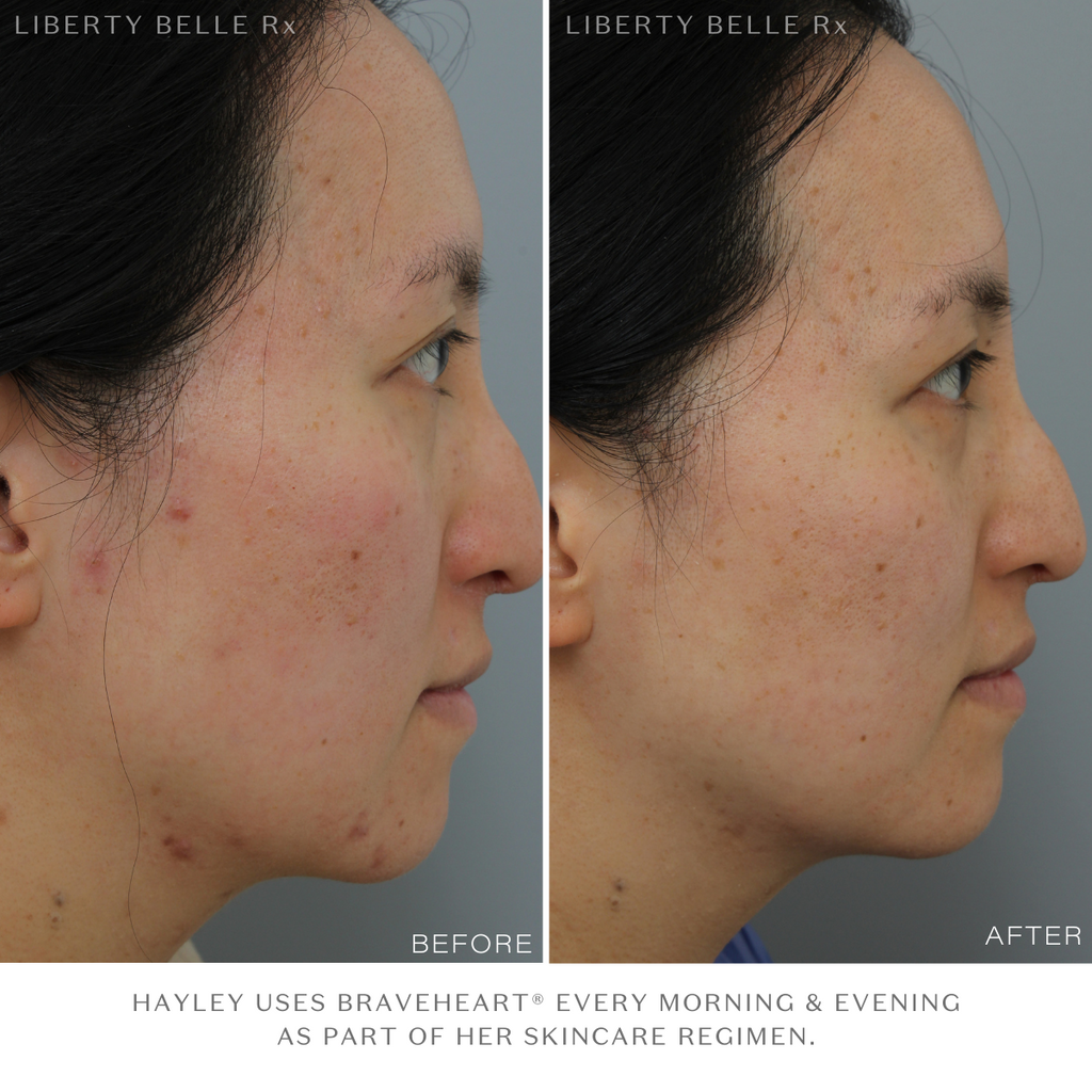 Braveheart® | Deep Clean Foaming Gel Cleanser | Liberty Belle Rx