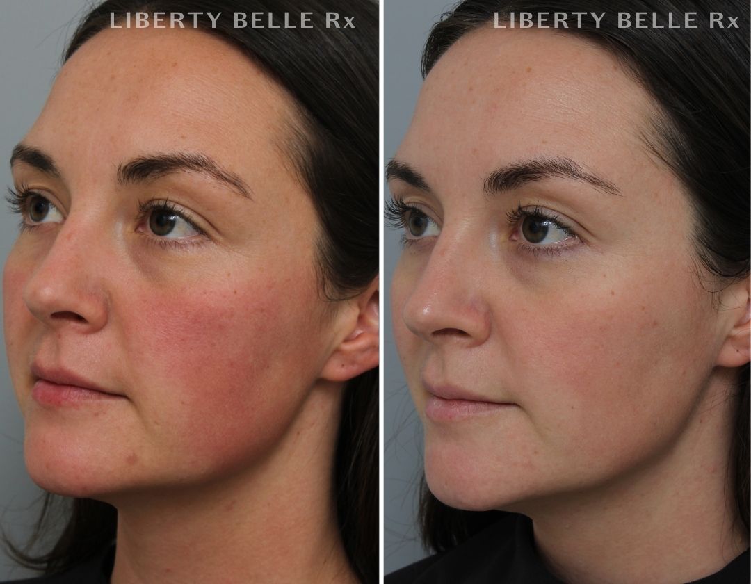 CAROLINE | Liberty Belle Rx