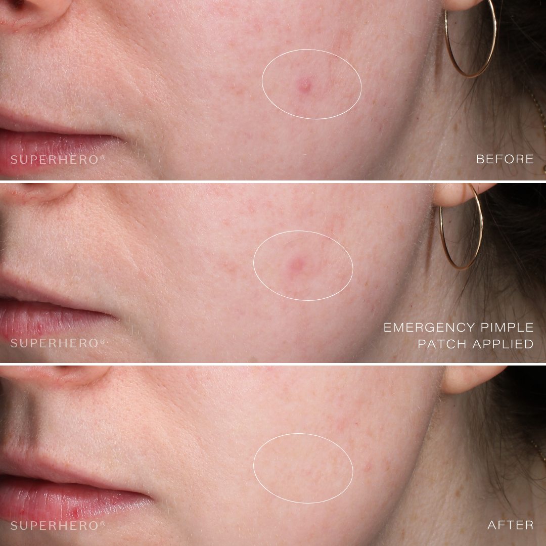 SKINCARE BEFORE & AFTER RESULTS | Liberty Belle Rx by Dr Chris Moss