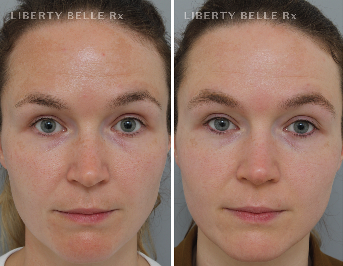 JASMINE | Liberty Belle Rx