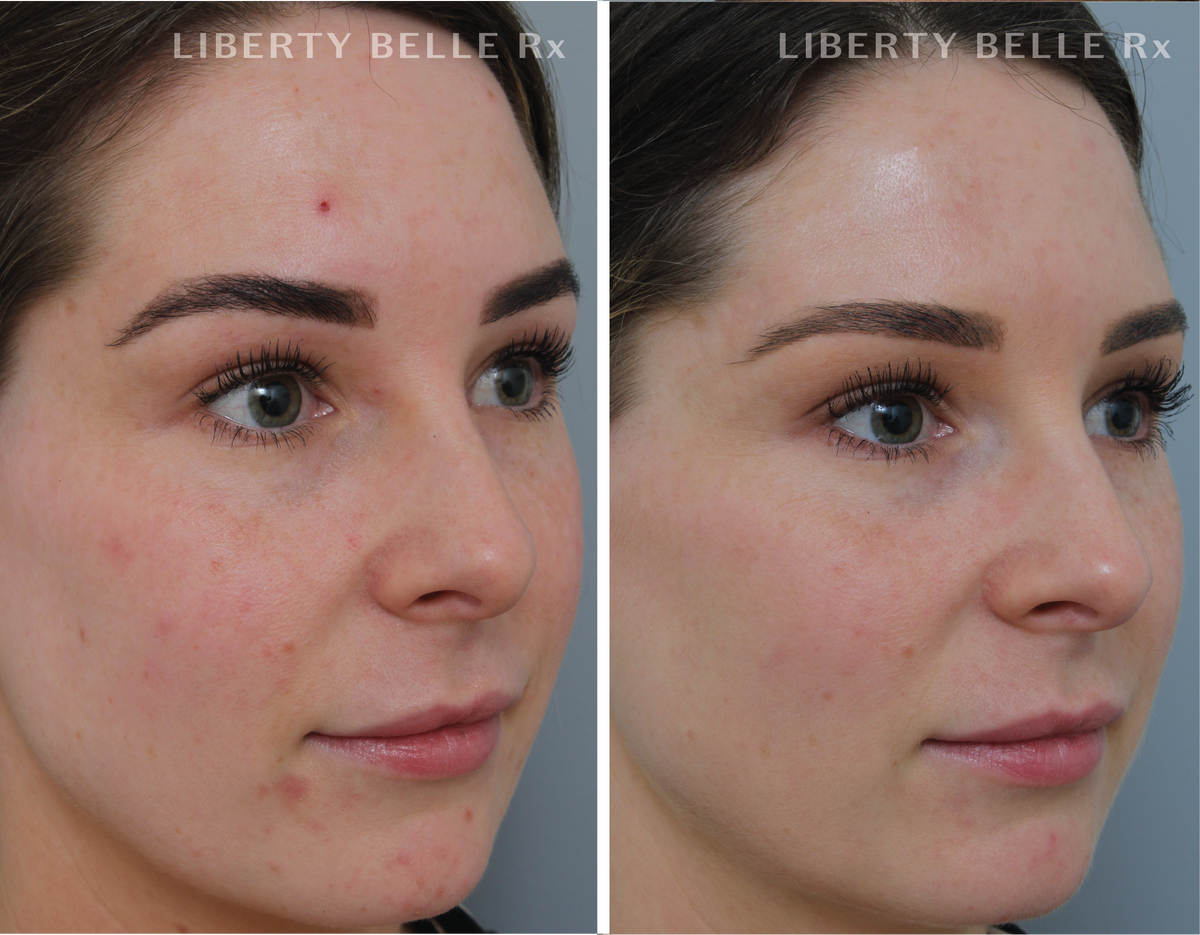 LAURA | Liberty Belle Rx