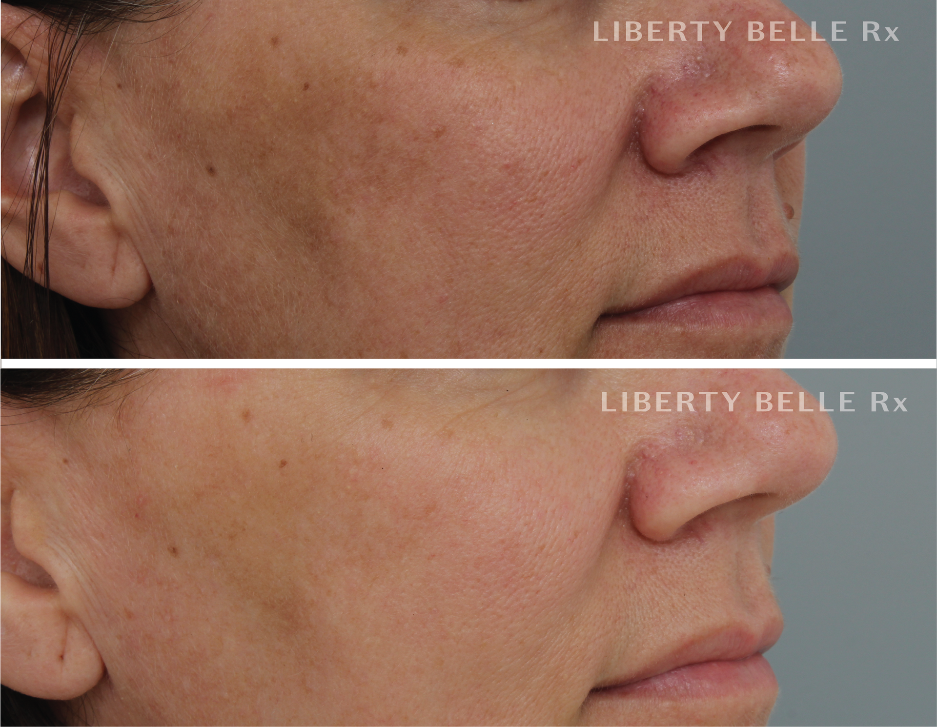 MELISSA | Liberty Belle Rx
