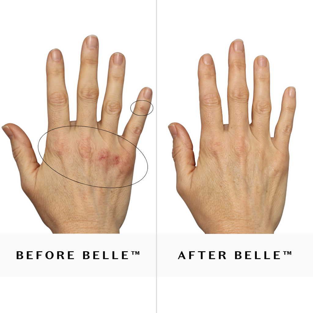Belle™ - Intensive Rejuvenating Hand Cream by Liberty Belle Rx